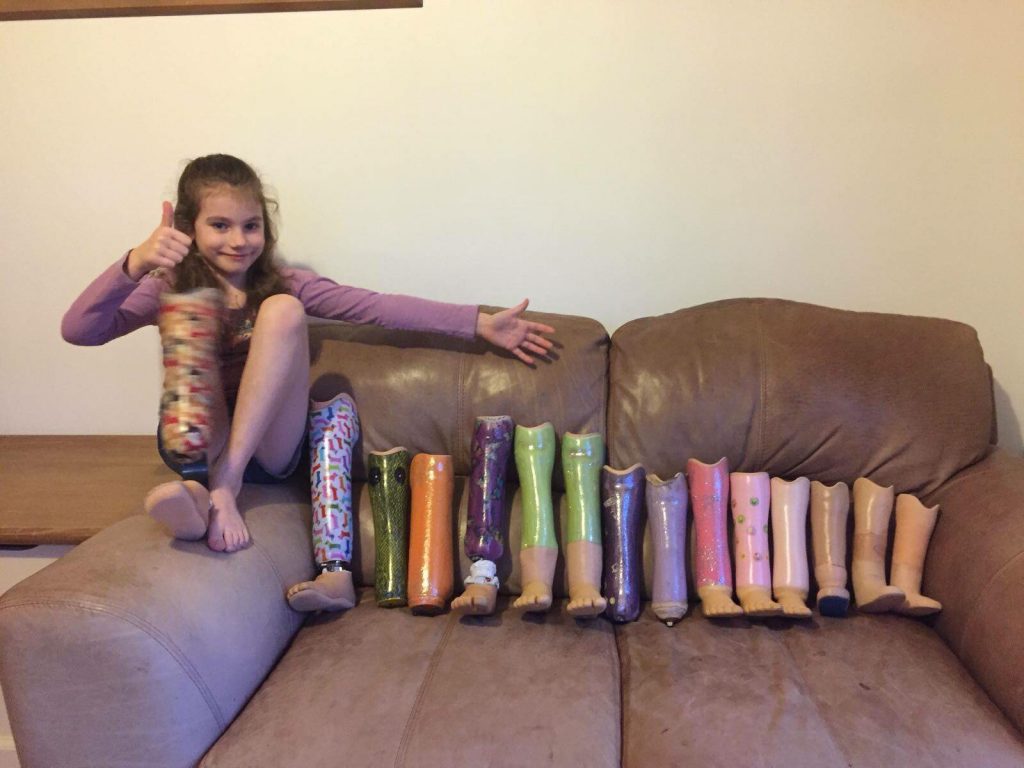 Celebrating Limb Loss Limb Difference Awareness Month - Steel Bones