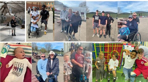 New Amputee? - Steel Bones